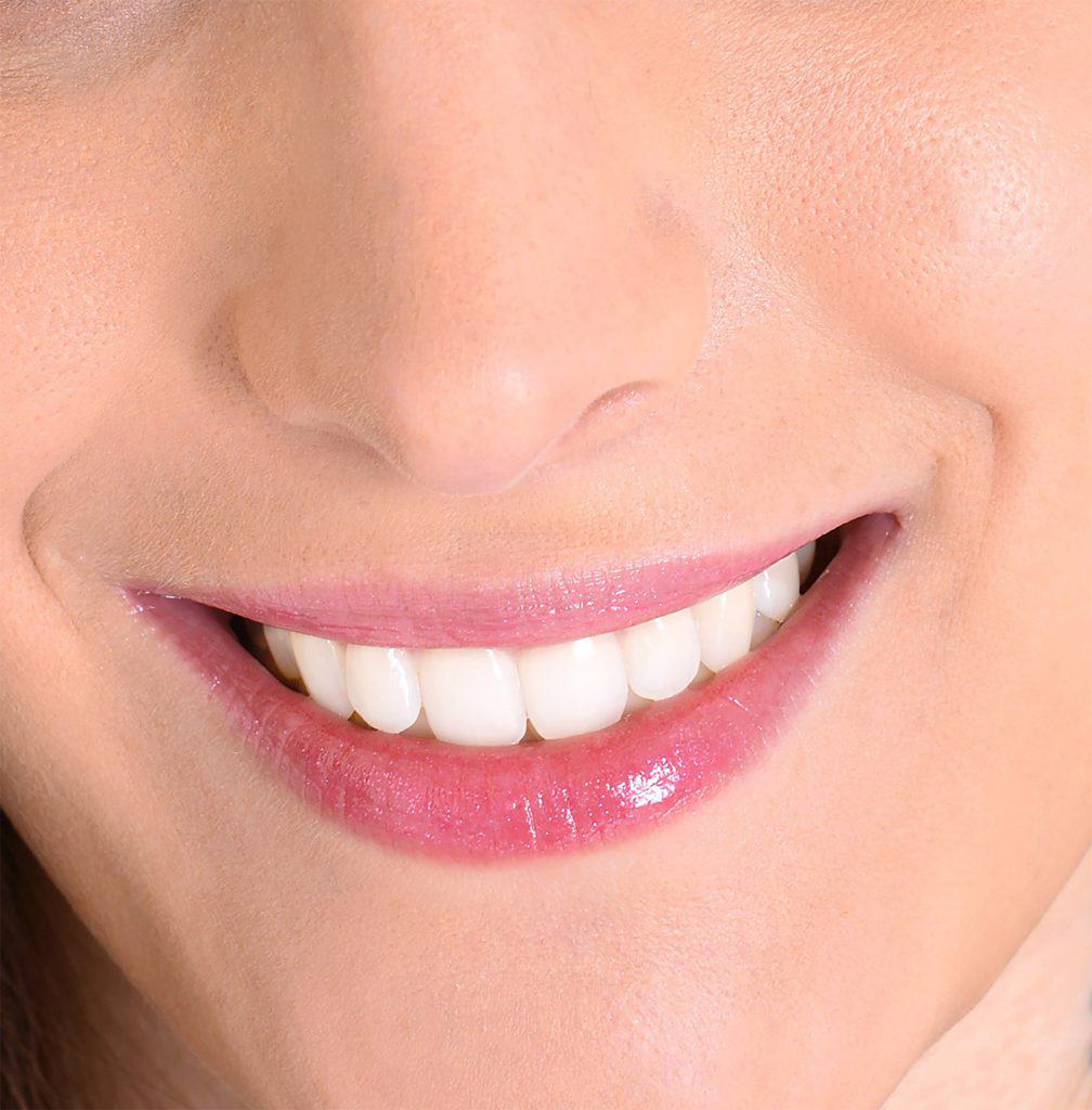 Complete Your Smile Makeover with a Dental Smile Lift